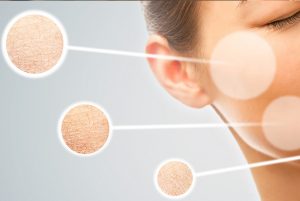 Dry Skin (Xerosis) | Advanced Dermatology, P.C.