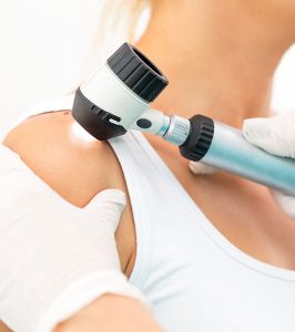 Squamous Cell Carcinoma Treatment in NY, NJ and CT