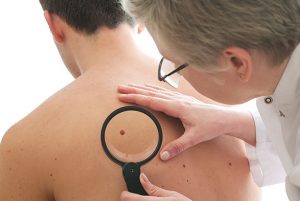 Dermatologist in Queens, NY | Advanced Dermatology, P.C.