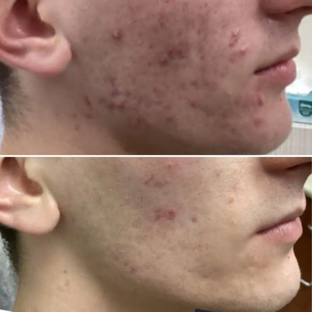 Jie Chen | Advanced Dermatology