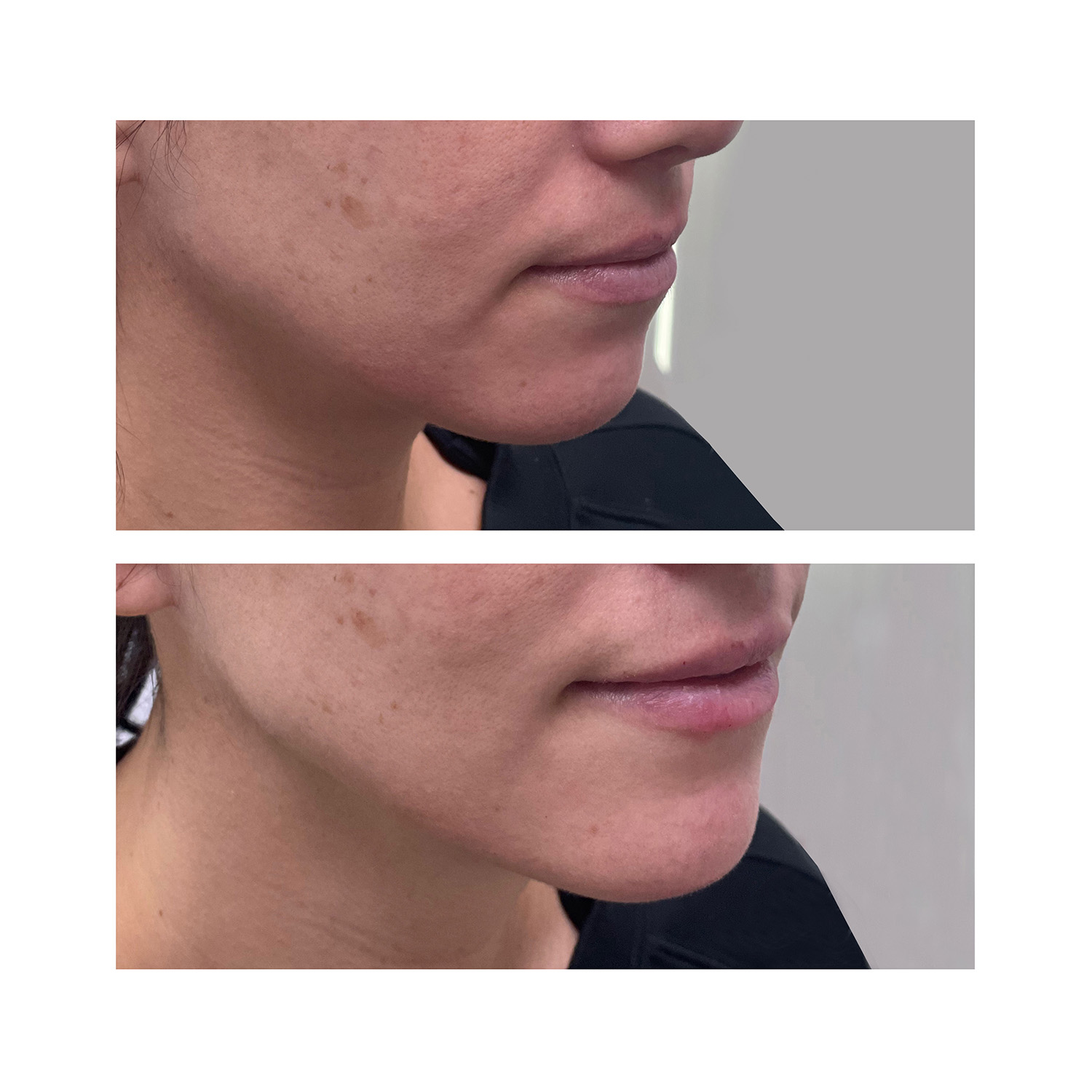 Yan Jin (Eve) | Advanced Dermatology, P.C.