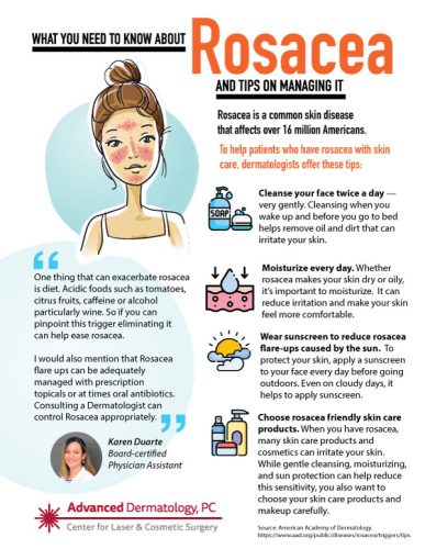 Tips on Managing Rosacea