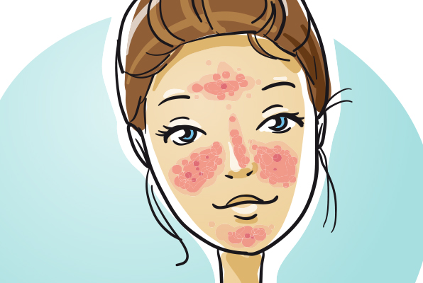 Latest Dermatology News | Advanced Dermatology Blog | Page 6